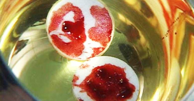 Varios Milagros Eucarísticos confirman el mismo tipo de sangre y ADN de ...